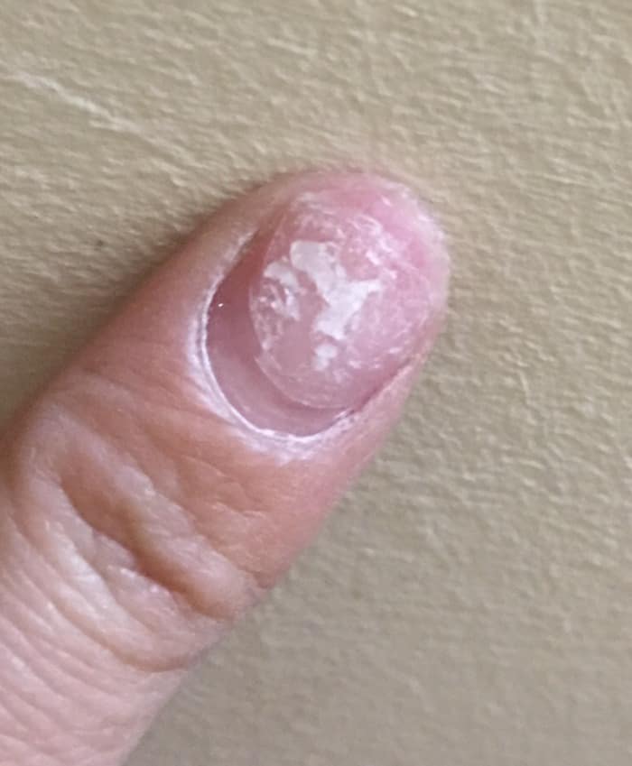 How to identify the cause of a nail break - Scratch Magazine