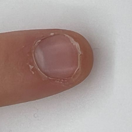 What is the function of the free edge of the nail? - Scratch Magazine