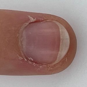 What is the function of the free edge of the nail? - Scratch Magazine